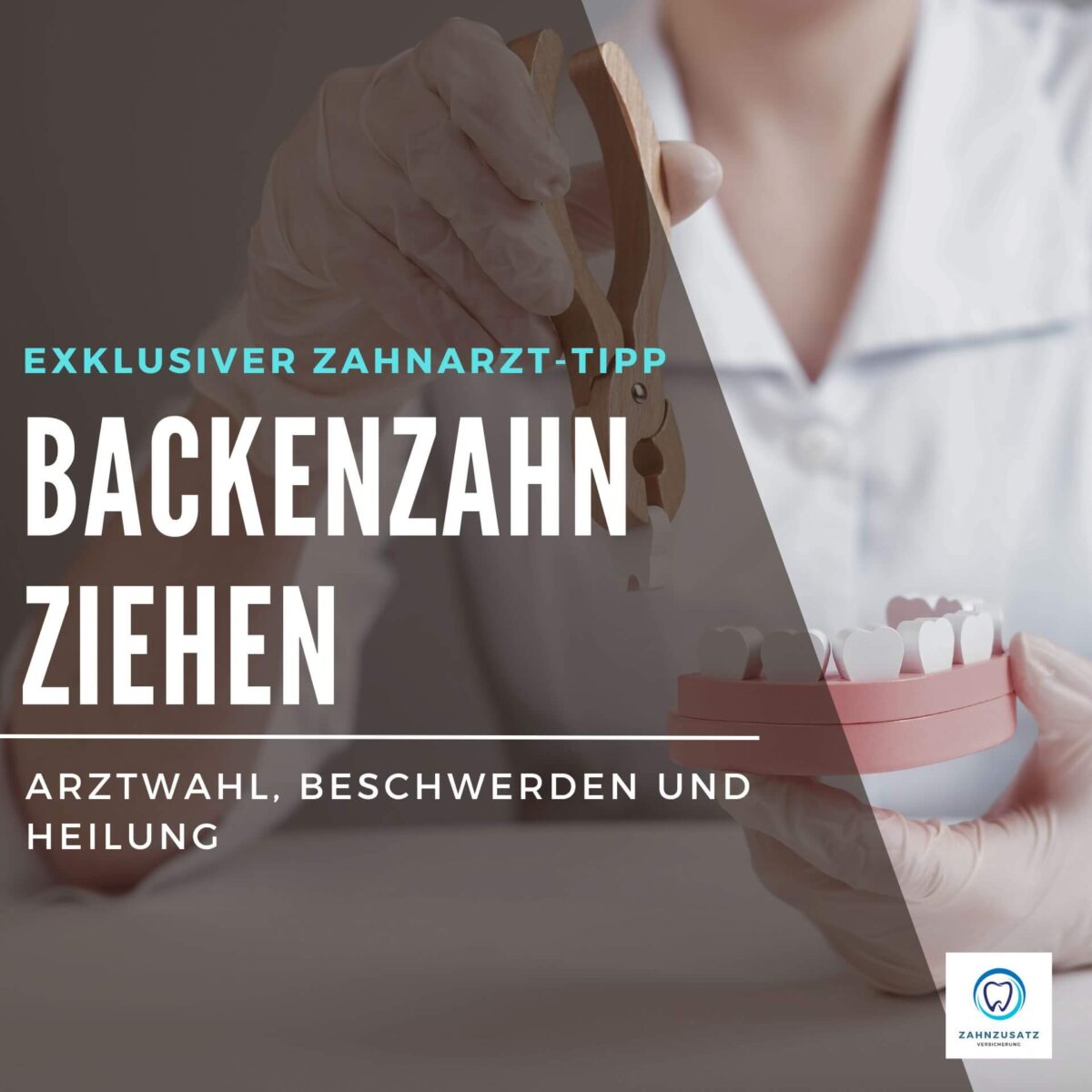ᐅ Backenzahn ziehen: Arztwahl, Beschwerden & Heilung