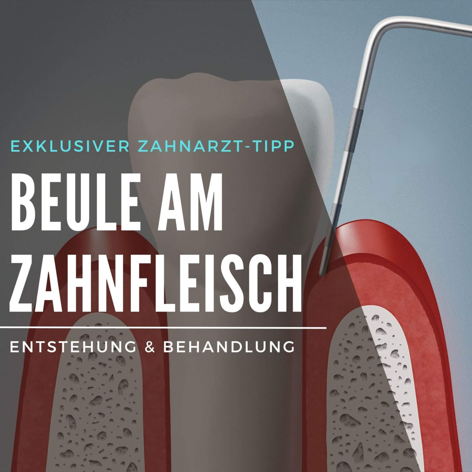 ᐅ Beule am Zahnfleisch: Entstehung & Behandlung