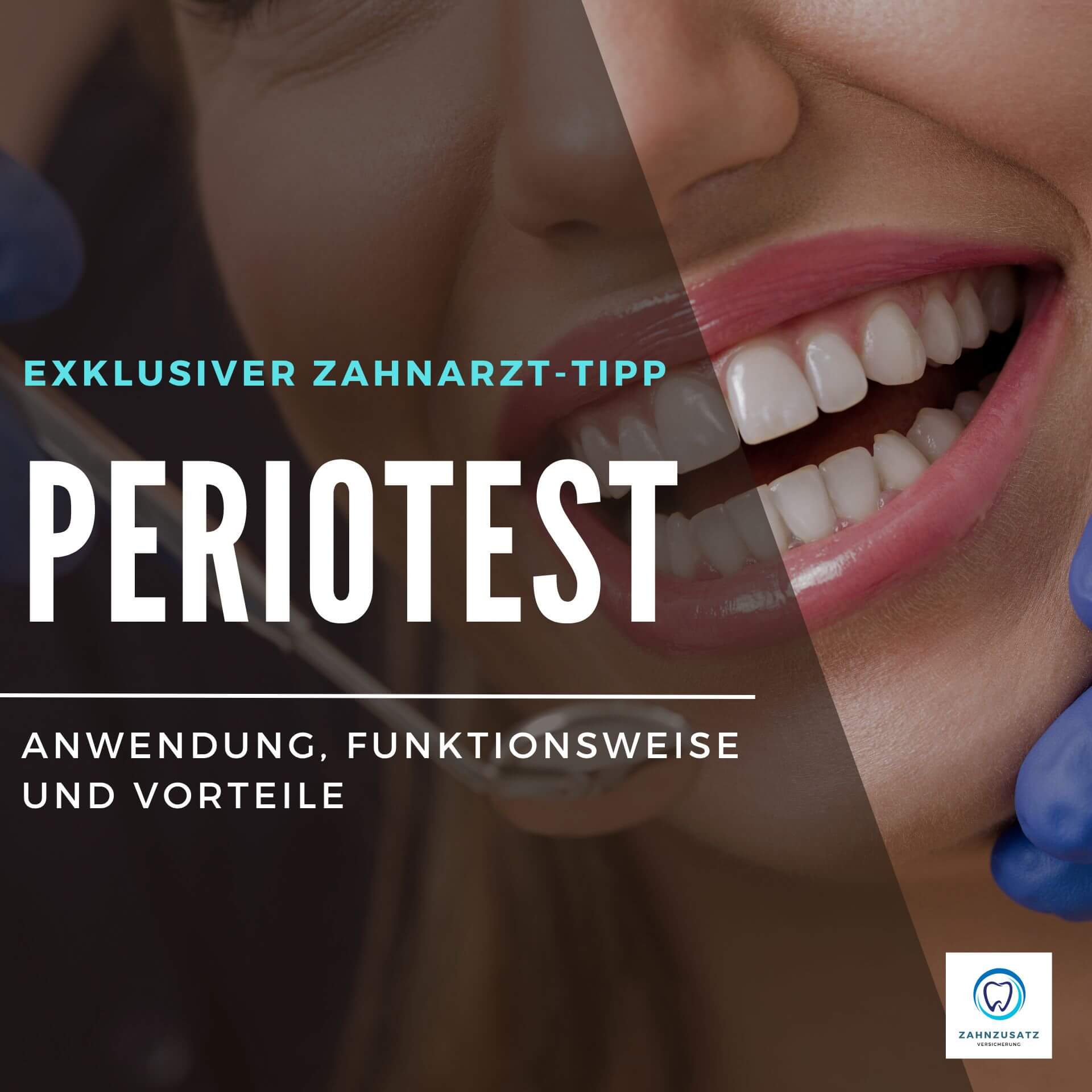 ᐅ Zahnkrone Ablauf: Schritt-für-Schritt zur neuen Zahnkrone