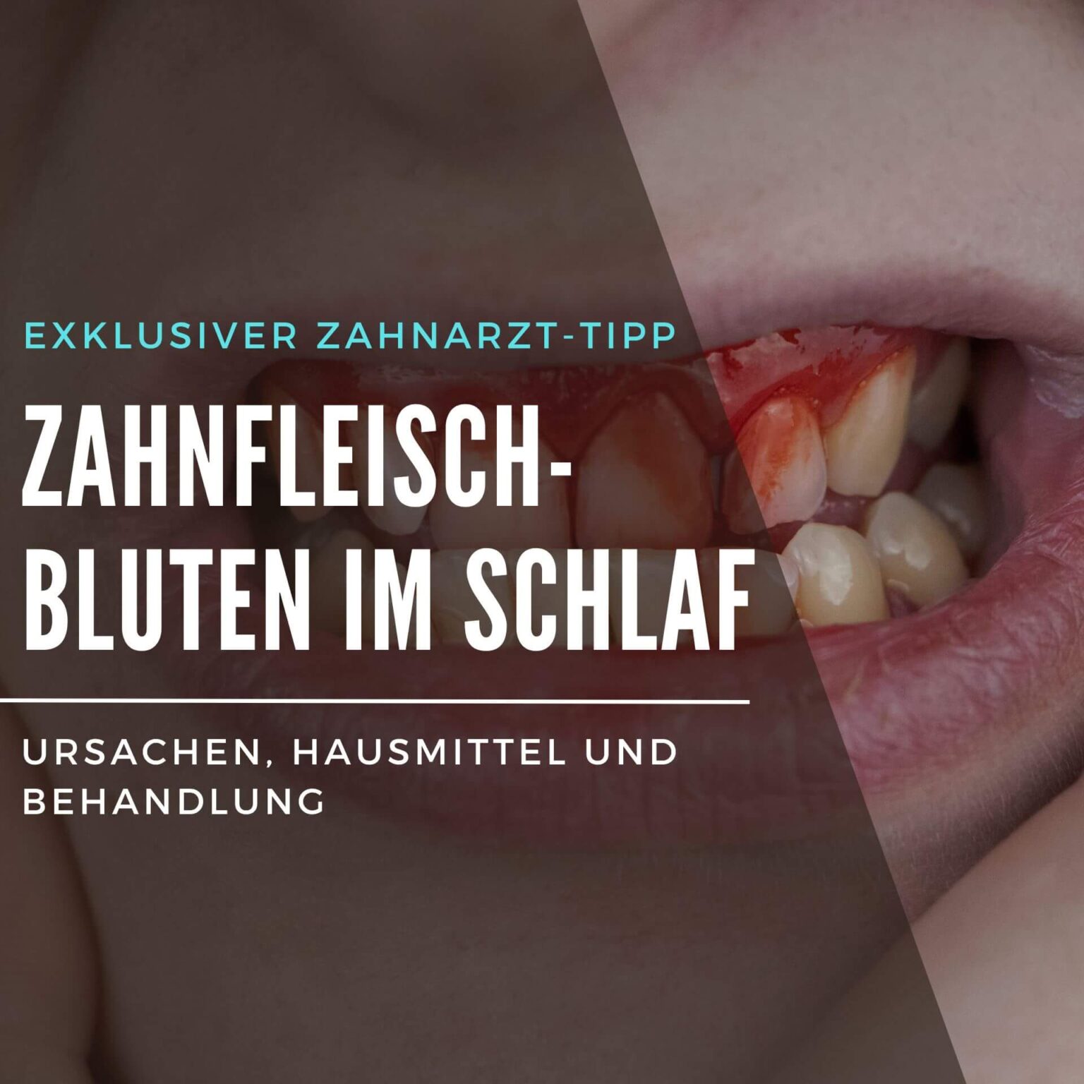 Parodontosebehandlung unnötig: Wann ist sie wirklich wichtig?