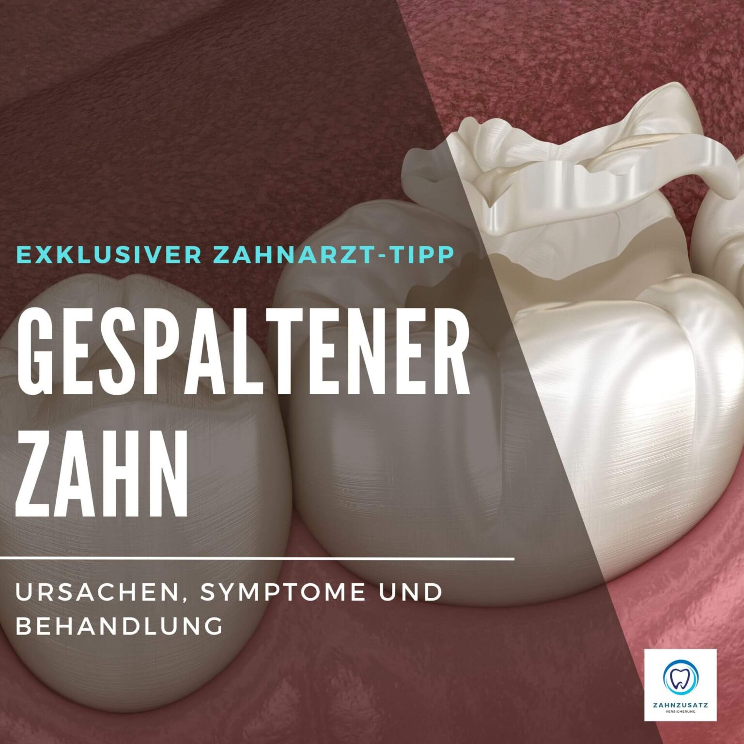 Okklusion in der Zahnmedizin: Grundlagen & Bedeutung