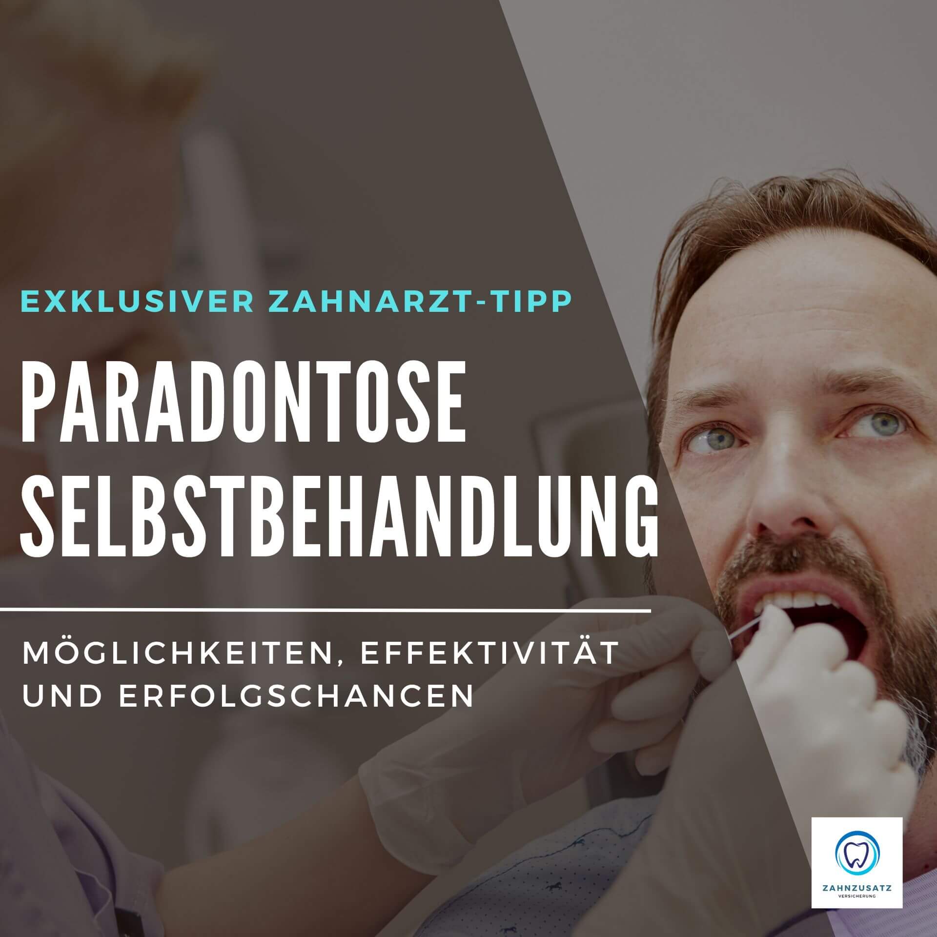 ᐅ Parodontose selbst behandeln: Möglichkeiten im Blick