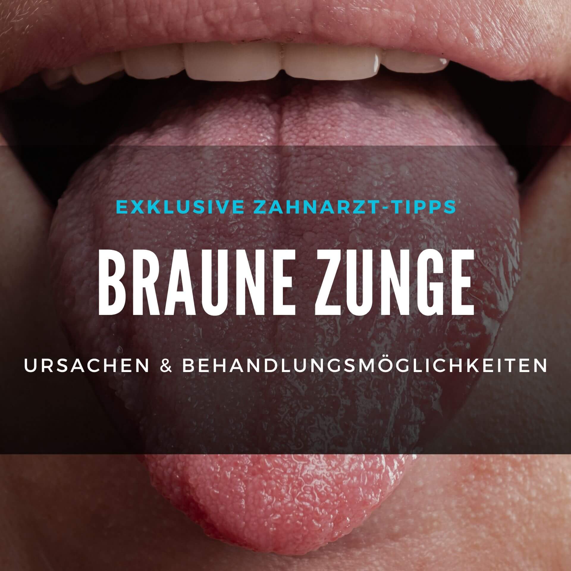 Braune Zunge: Ursachen & Behandlungsmöglichkeiten
