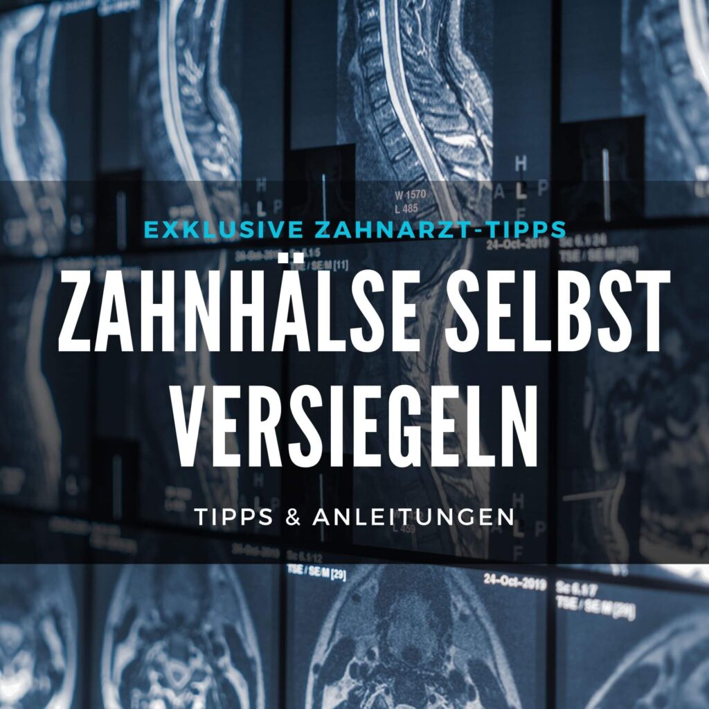 Kavität Zahn: Verstehen, Vorbeugen und Behandeln