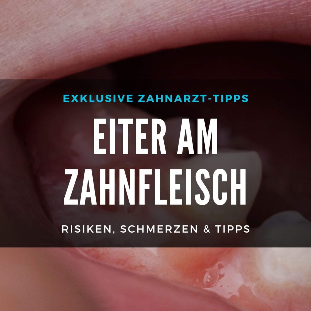 Zahnschmerzen kühlen oder wärmen: Wann welche Methode hilft