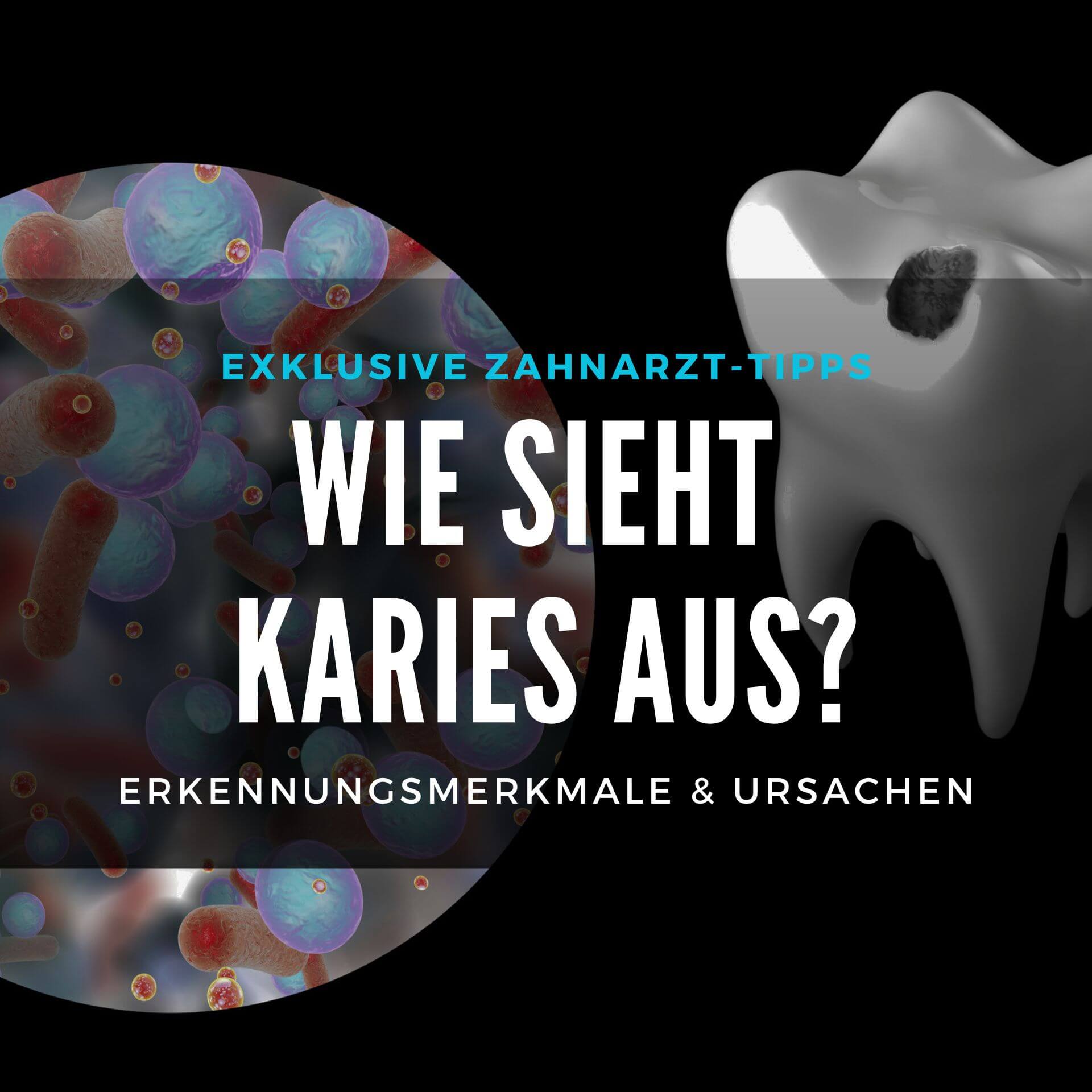 Wie sieht Karies aus? Erkennungsmerkmale & Ursachen